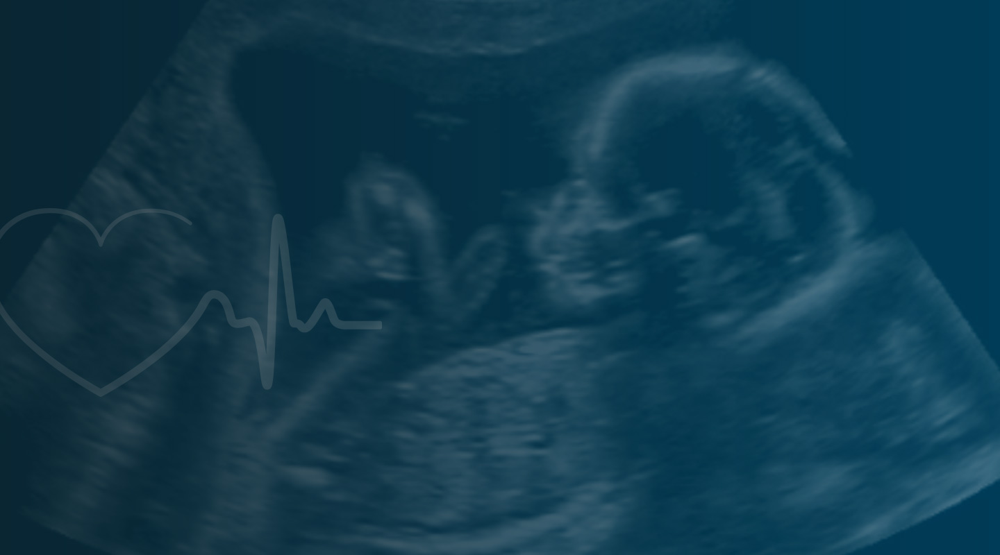 The 5-Minute Pro-Lifer